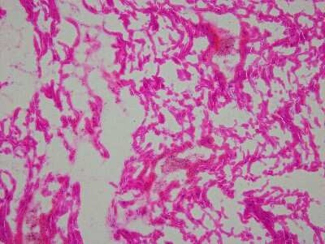 Novus Biologicals Heart Ventricle Tissue Slides (Hypertension Left ...