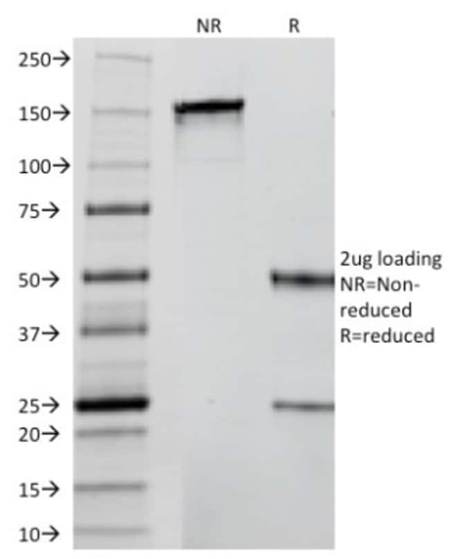 Insulin Antibody (2D11-H5 (same as INS05)), Novus Biologicals ...
