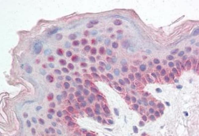 KDM2B Antibody, Novus Biologicals 0.1mg; Unlabeled:Antibodies ...