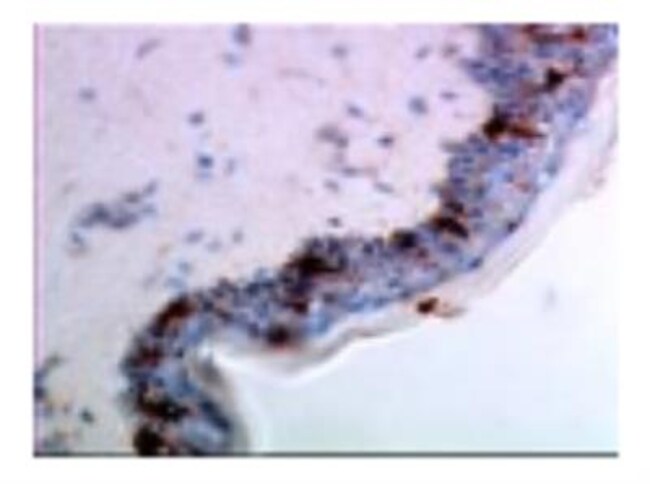 Langerin/CD207 Antibody (306G9), Novus Biologicals 0.1mg; Unlabeled ...