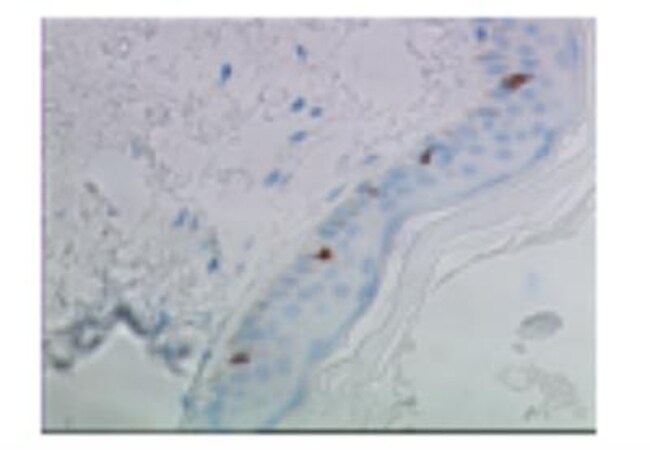 Langerin/CD207 Antibody (306G9), Novus Biologicals 0.1mg; Unlabeled ...