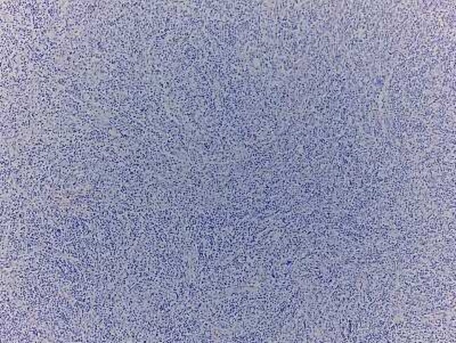 Novus Biologicals Lymph Node Tissue Slides (Hyperplasia)- Paraffin 5 ...