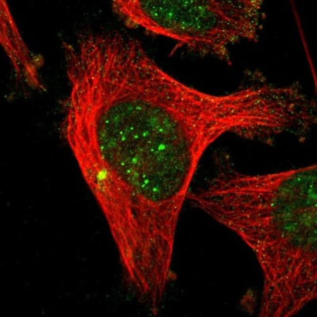 MLF1 Interacting Protein Antibody, Novus Biologicals:Antibodies:Primary ...