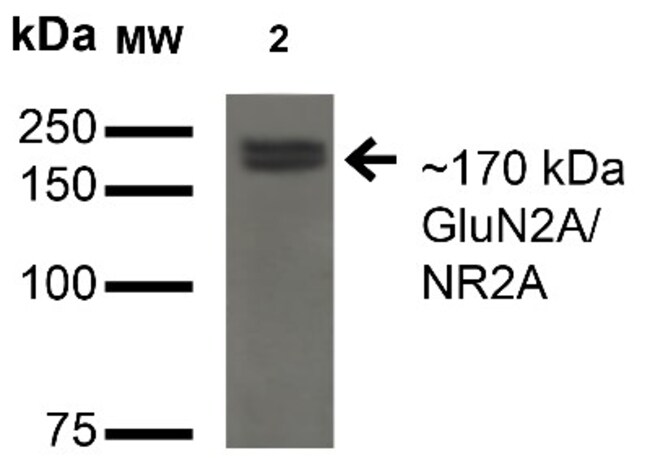 NMDAR2A Antibody (S327A-38), Novus Biologicals:Anticuerpos:Anticuerpos ...