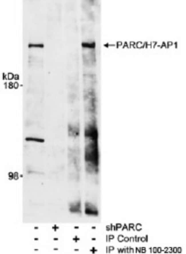 PARC Antibody 0.1mg; Unlabeled:Antibodies, Polyclonal | Fisher Scientific