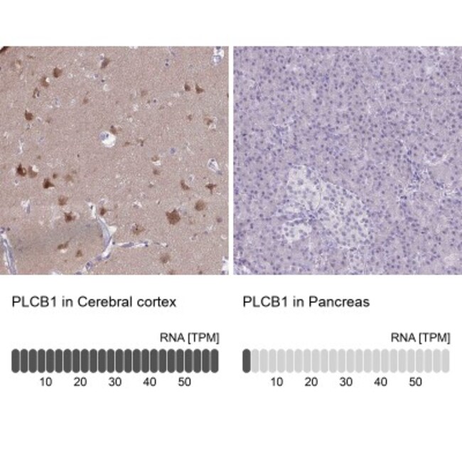 PLC-beta 1 Antibody, Novus Biologicals:Antibodies:Primary Antibodies ...