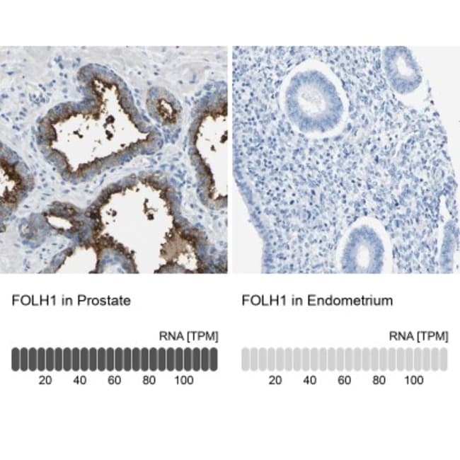 PSMA/FOLH1/NAALADase I Antibody, Novus Biologicals:Antibodies:Primary ...