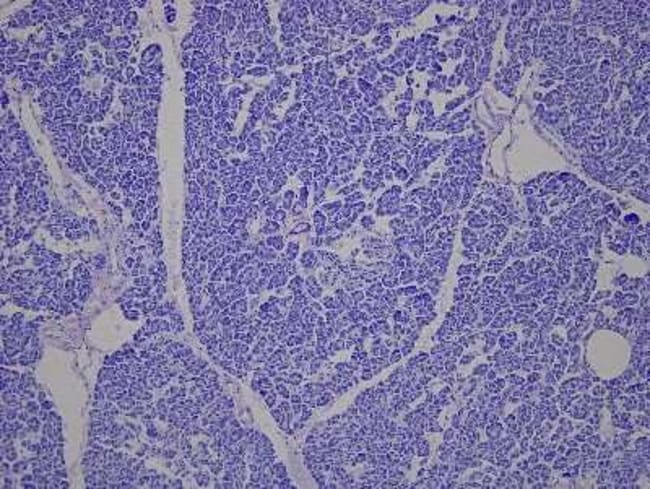 Novus Biologicals Pancreas Tissue Slides (Lupus)- Paraffin 5 Slides ...