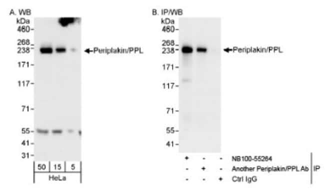 Periplakin Antibody 0.1mL; Unlabeled:Antibodies, Polyclonal | Fisher ...