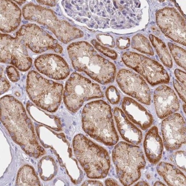 Puromycin-sensitive aminopeptidase/NPEPPS Antibody, Novus Biologicals ...