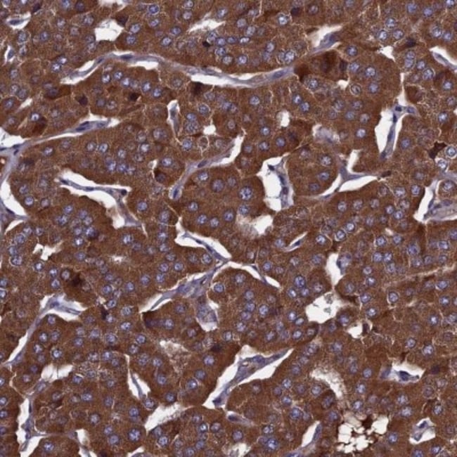 RAB15 Antibody, Novus Biologicals 0.1mL; Unlabeled:Antibodies ...