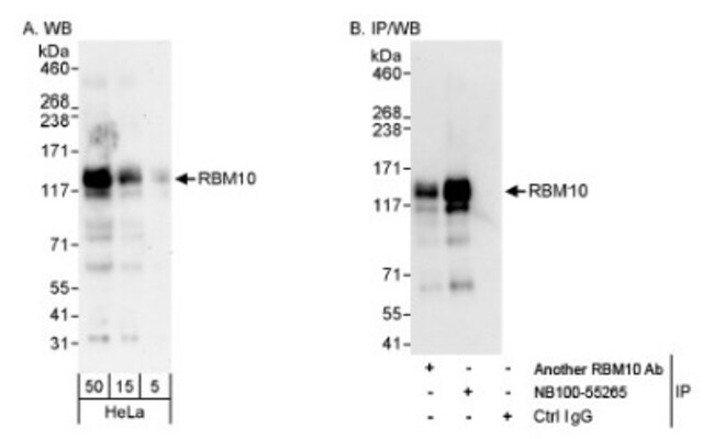RBM10 Antibody 0.1mL; Unlabeled:Antibodies, Polyclonal | Fisher Scientific