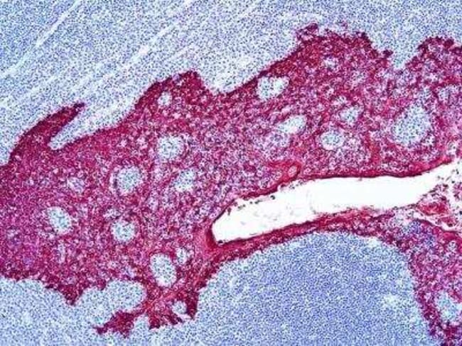 Novus Biologicals RED HRP Staining Kit (Colorimetric) | Fisher Scientific