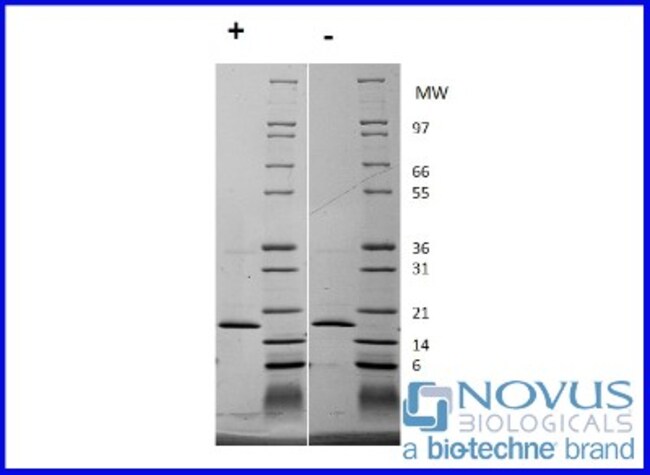 Novus Biologicals Recombinant Human FGF basic/FGF2 Animal-Free Protein ...