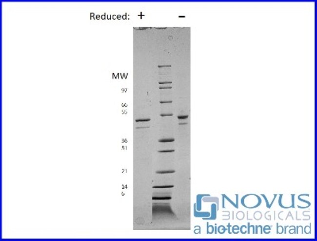 Novus Biologicals Recombinant Human PBEF/Visfatin/NAMPT Protein ...