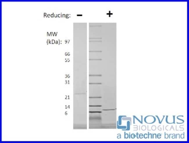 Novus Biologicals Recombinant Human Persephin Animal-Free Protein ...