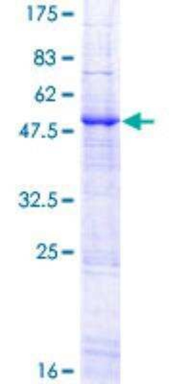 Novus Biologicals Recombinant Human APOBEC3B GST (N-Term) Protein 25 μg ...