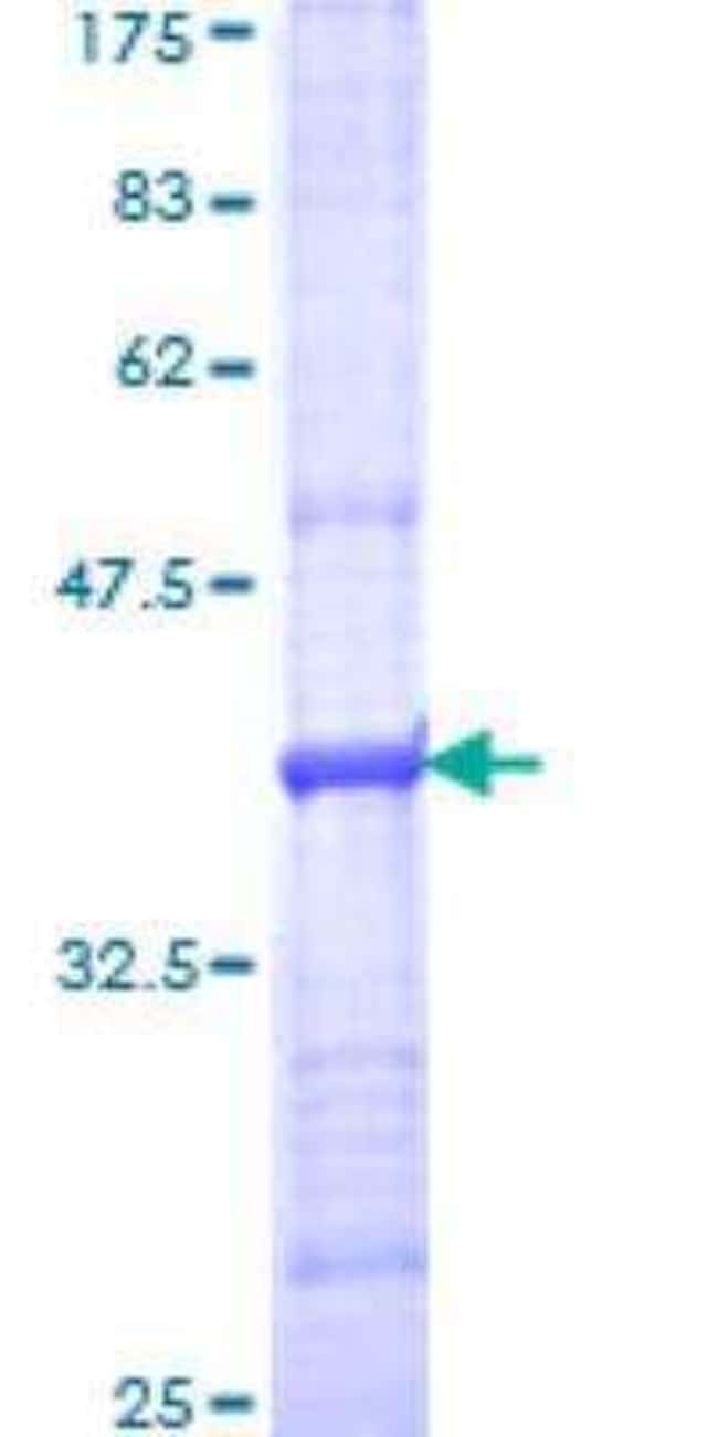 Novus Biologicals™ Recombinant Human Complement C5 Gst N Term Protein