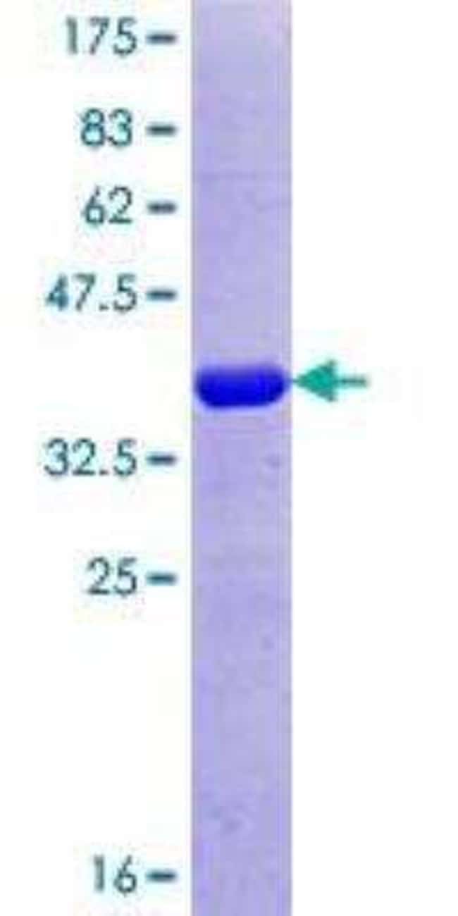 Novus Biologicals Recombinant Human Fibrillin 2 GST (N-Term) Protein 10 ...