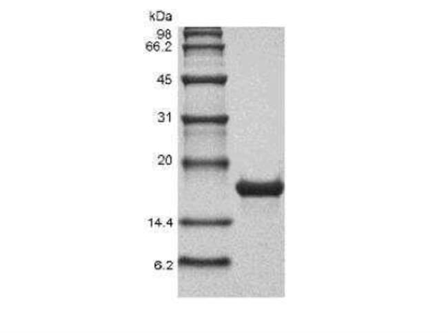 Novus Biologicals Recombinant Human M-CSF Protein 10 μg:Recombinant ...