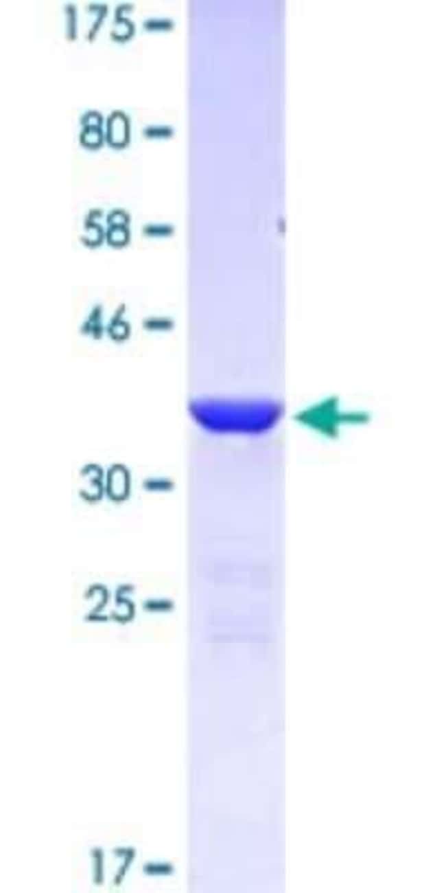 Novus Biologicals™ Recombinant Human Talin1 GST (N-Term) Protein 25 μg ...