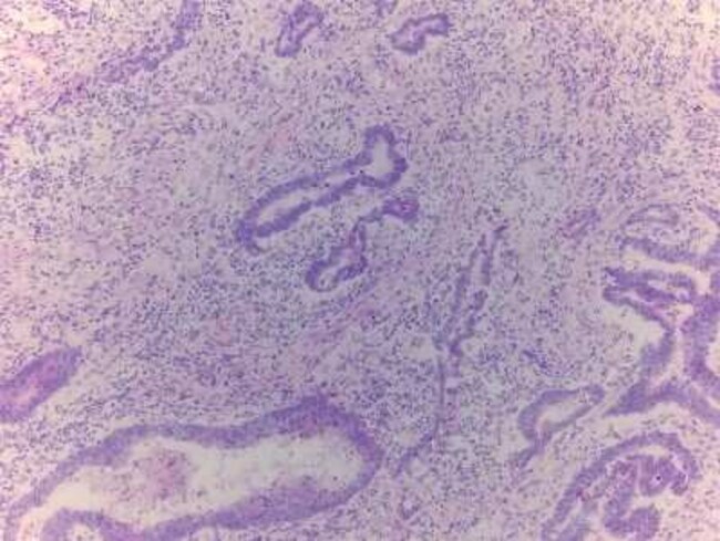 Novus Biologicals Rectal Tissue Slides (Tumor)- Frozen 5 Slides:Protein ...