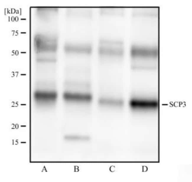 SCP3/SYCP3 Antibody (6F9C5), Novus Biologicals 0.1mL; Unlabeled ...