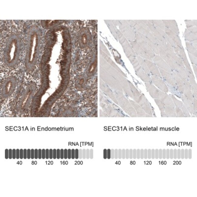 SEC31A Antibody, Novus Biologicals 0.1mL; Unlabeled:Antibodies ...
