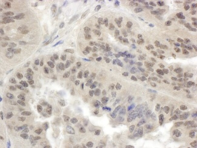 SMG1 Antibody 0.1mg; Unlabeled:Antibodies, Polyclonal | Fisher Scientific