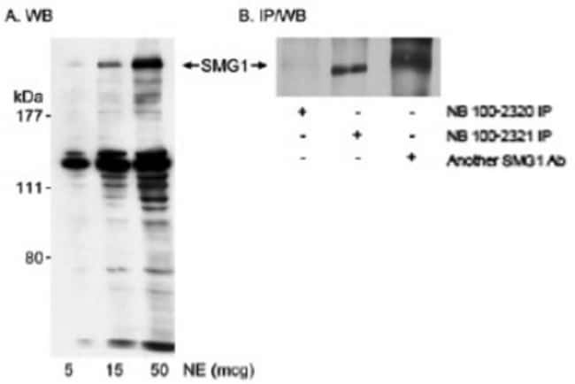SMG1 Antibody 0.1mg; Unlabeled:Antibodies, Polyclonal | Fisher Scientific