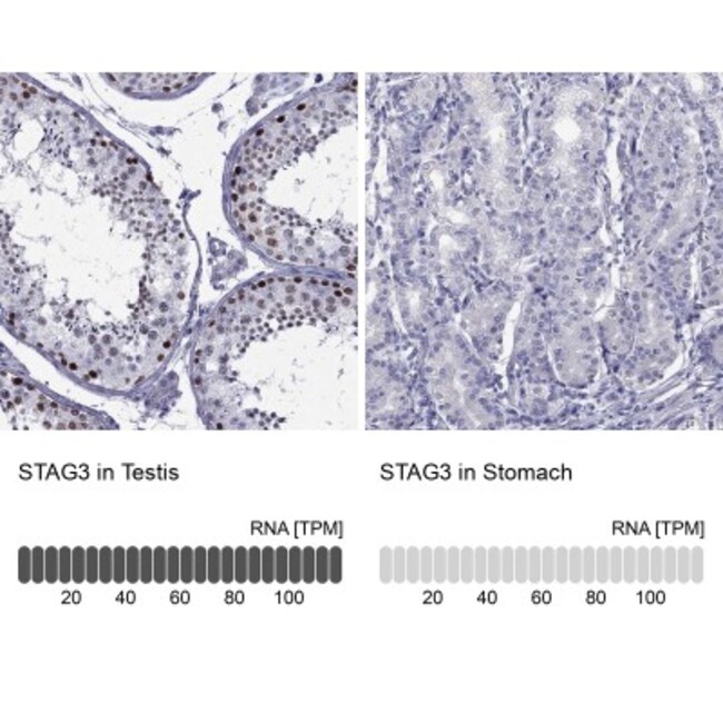 Rabbit anti-STAG3, Polyclonal, Novus Biologicals 0.1mL; Unlabeled:Life ...