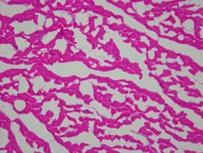 Novus Biologicals Skeletal Muscle Tissue Slides (Diabetes)- Frozen 5 ...