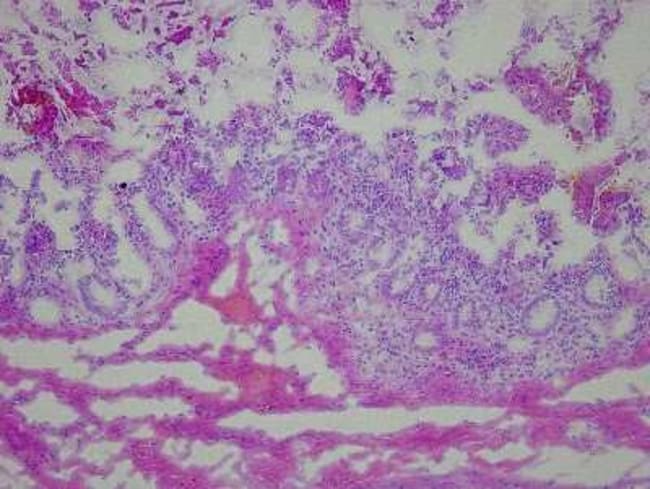 Novus Biologicals Small Intestine Ileum Tissue Slides (Diabetes ...