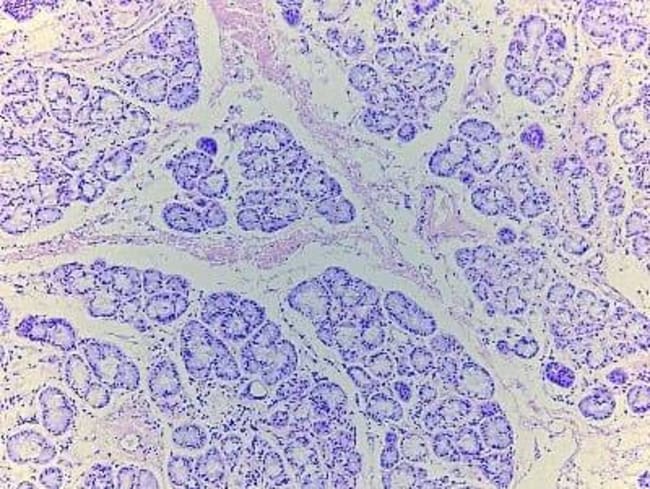 Novus Biologicals Throat Tissue Slides (Adult Normal)- Paraffin 5 ...