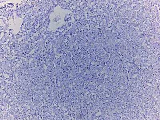 Novus Biologicals Thyroid Tissue Slides (Nodular Goiter)- Paraffin 5 ...