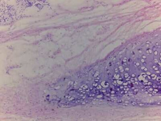 Novus Biologicals Trachea Tissue Slides (Adult Normal)- Frozen 5 Slides ...