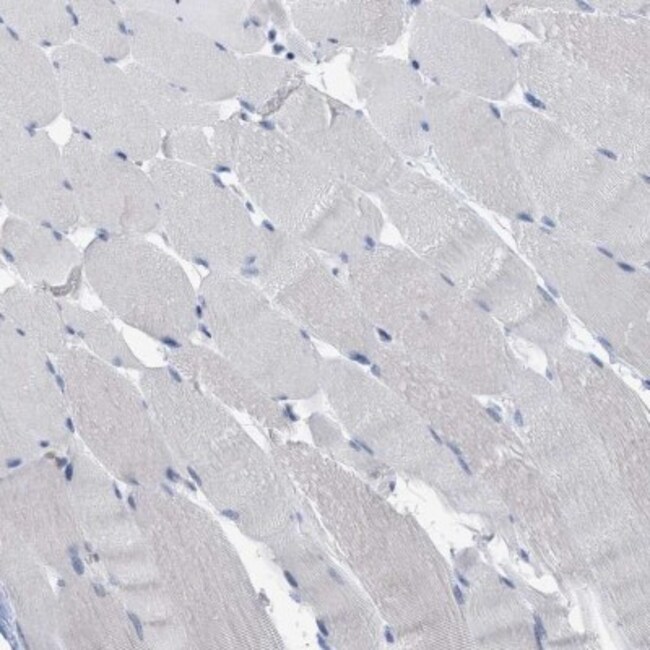 Transgelin/TAGLN/SM22 alpha Antibody, Novus Biologicals™ 25 μL ...