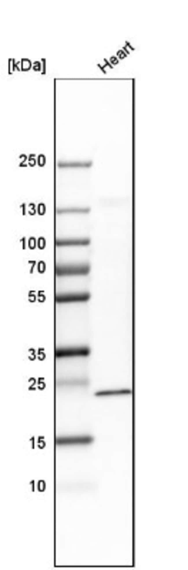 Transgelin/TAGLN/SM22 alpha Antibody, Novus Biologicals™ 25 μL ...