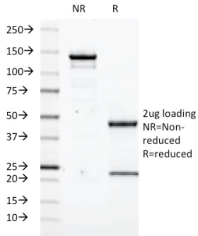 Mouse anti-Transglutaminase 2/TGM2, Clone: TGM2/419, Novus Biologicals ...