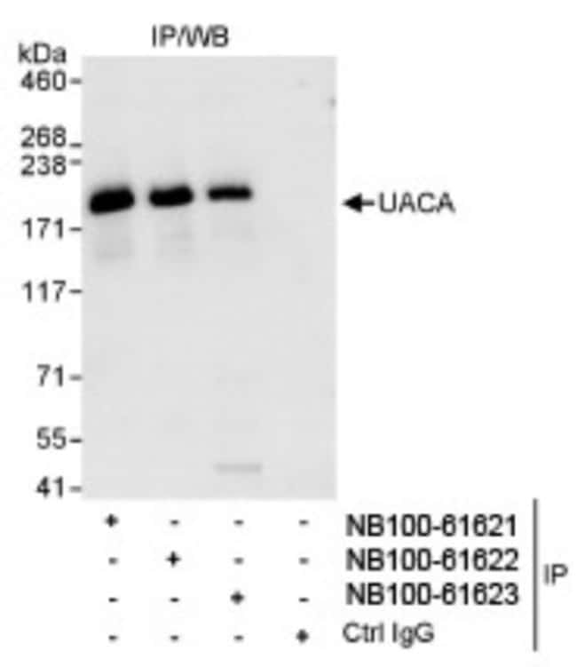 UACA Antibody 0.1mg; Unlabeled:Antibodies, Polyclonal | Fisher Scientific