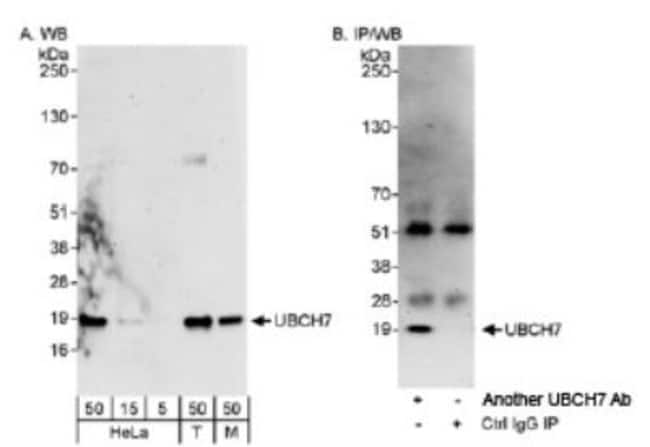 UbcH7/UBE2L3 Antibody 0.1mg; Unlabeled:Antibodies, Polyclonal | Fisher ...