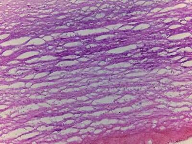 Novus Biologicals Vein Tissue Slides (Adult Normal)- Frozen 5 Slides ...