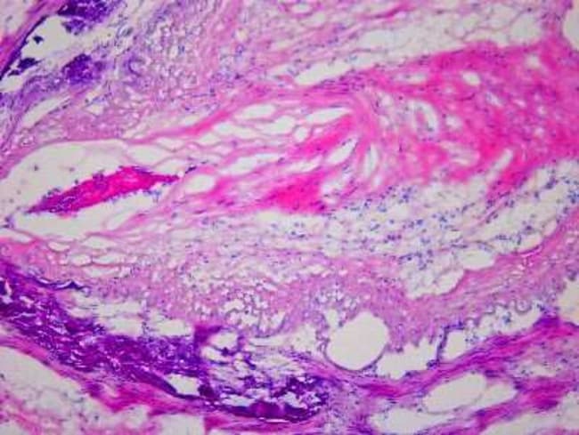 Novus Biologicals Vein Tissue Slides (Hypertension)- Frozen 5 Slides ...
