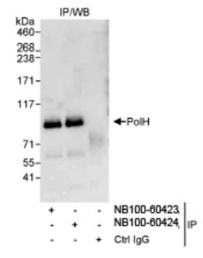 XPV/DNA polymerase eta Antibody 0.1mg; Unlabeled:Antibodies, Polyclonal ...