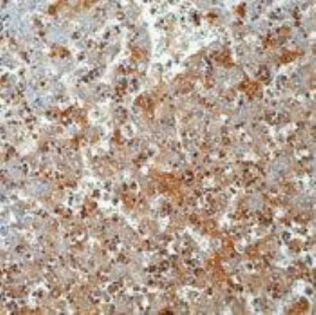 alpha-Fetoprotein/AFP Rabbit anti-Human, Polyclonal, Novus Biologicals ...