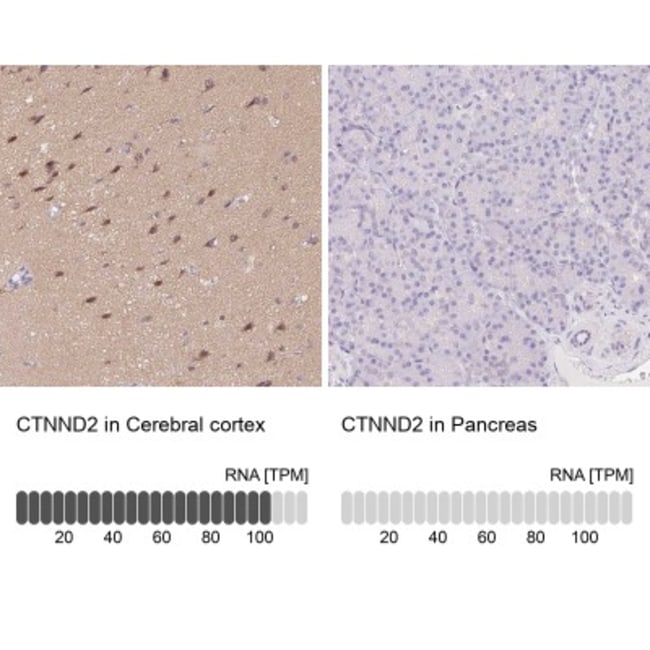 DELTA 2 CATENIN - 0.1 ML