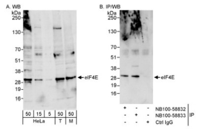eIF4E Antibody 0.1mL; Unlabeled:Antibodies, Polyclonal | Fisher Scientific