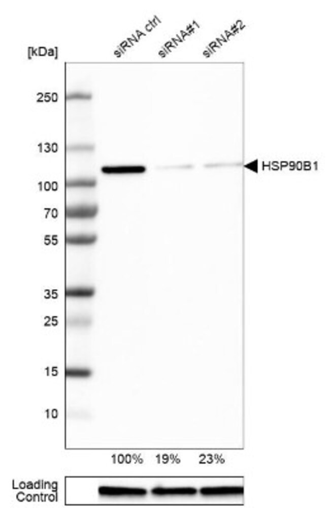 gp96/HSP90B1/GRP94 Antibody, Novus Biologicals 0.1mL; Unlabeled ...