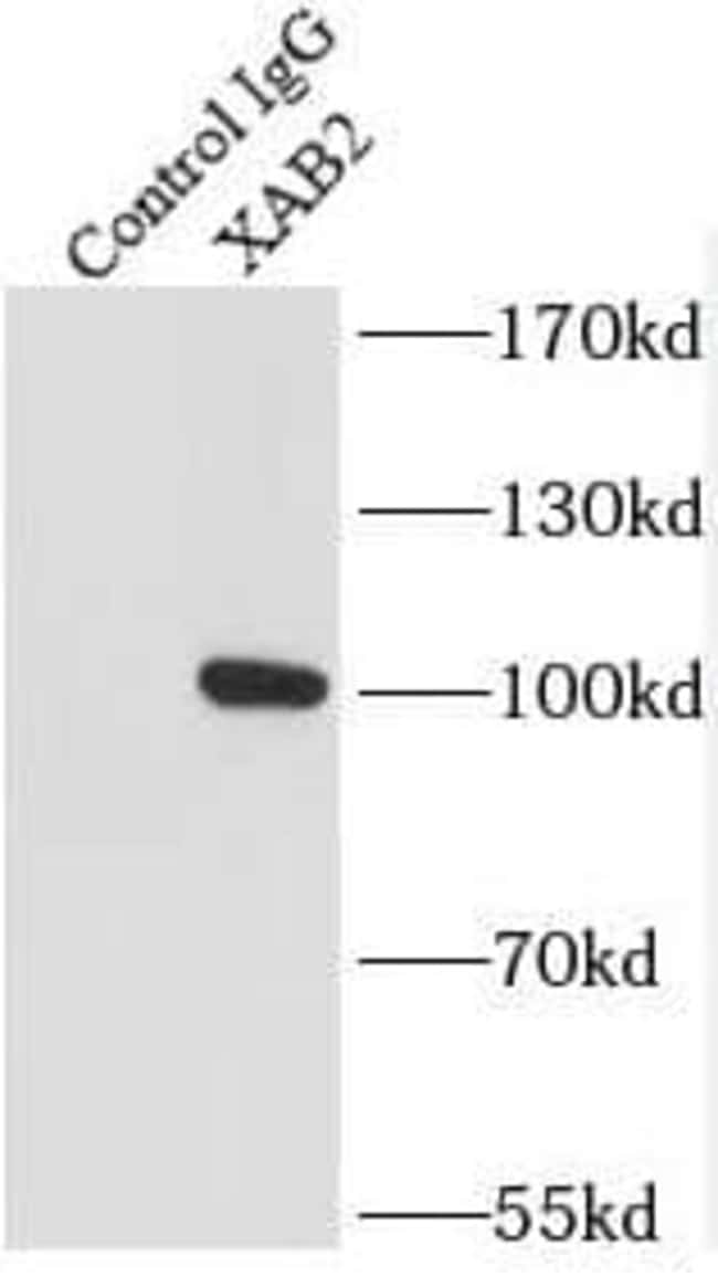 XAB2 Antibody - BSA Free, Novus Biologicals 100 μg; Unconjugated ...