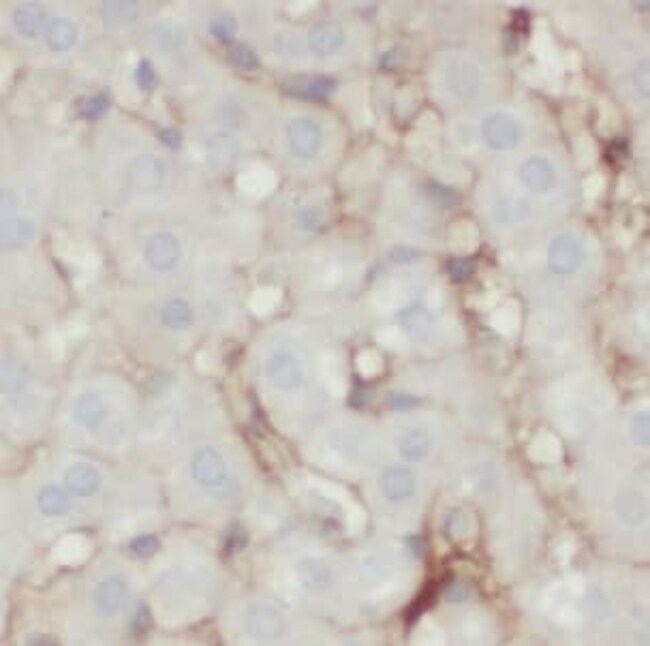 HSD17B7 Antibody - BSA Free, Novus Biologicals 100 μg; Unconjugated ...